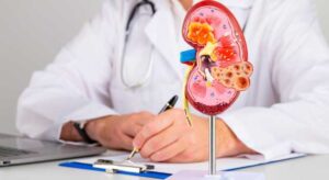 Kamen u Bubregu | Simptomi i Lečenje MSB